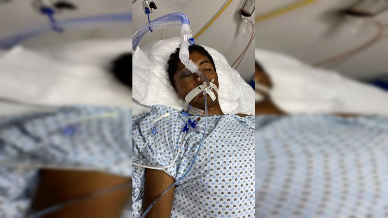 Exitosa cirugía de cráneo en paciente en calidad de desconocido en el ...