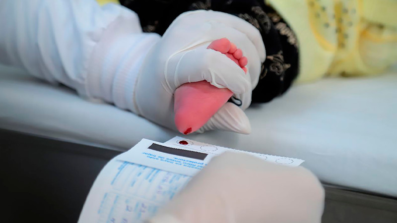 Llama Salud Michoacán a realizar el tamiz neonatal para detectar ...